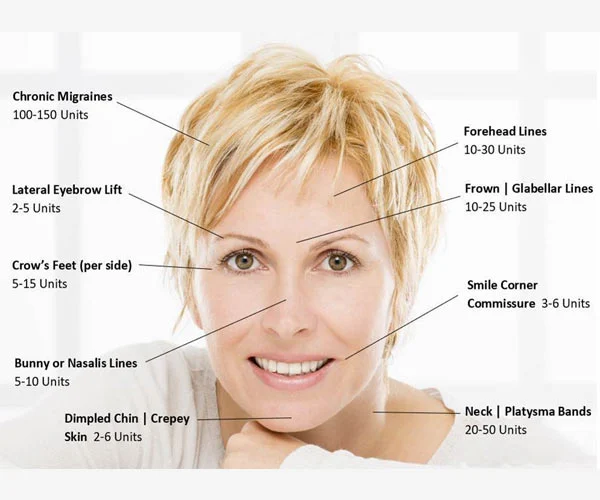 Guía Para Inyeccion De Botox En El Rostro | IAMT