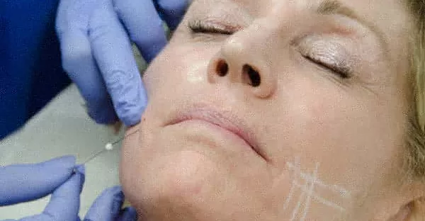 Curso de Terapias Combinadas Con Hilos PDO, Rellenos Dérmicos Y Más | IAMT